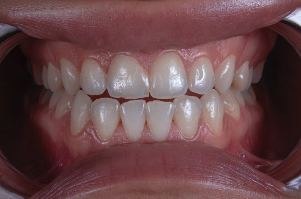 September Is Gum Care Month!